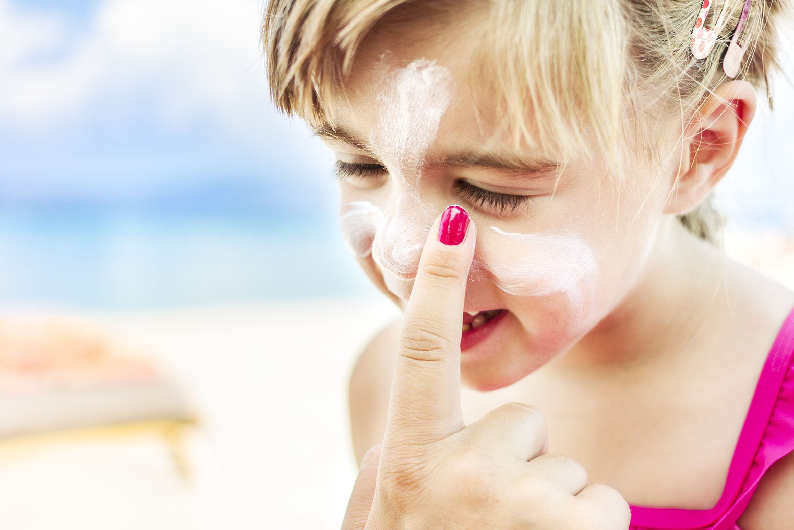 Sunburn in adults and children | University Health Practice